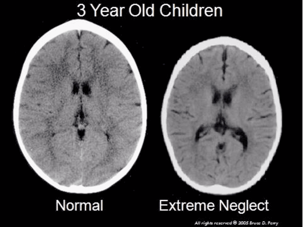 Why Ages 0-3 are the MOST Crucial Years of Brain Development ...